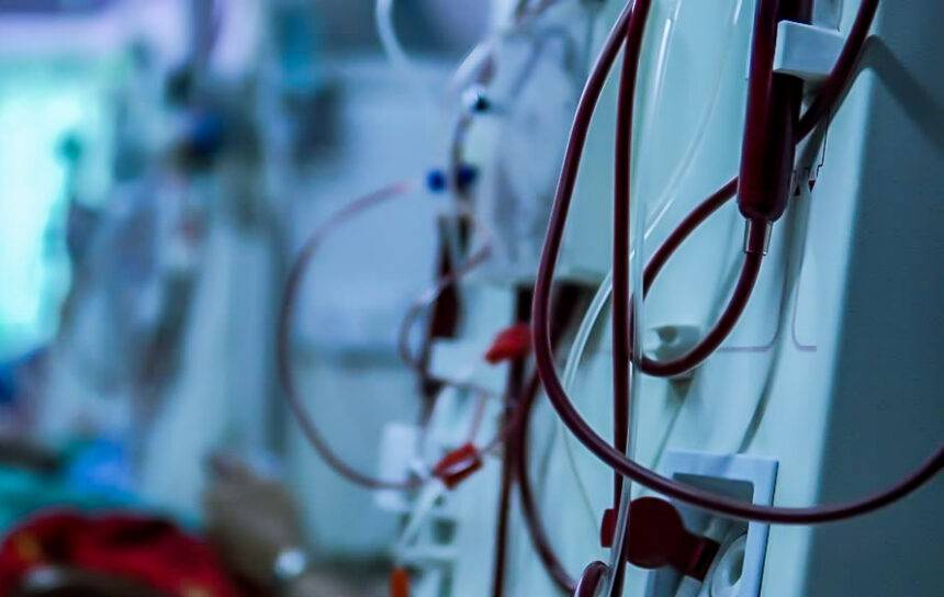 How Dialysis Equipment Enhances Comfort and Safety? | Siela medikal